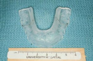 Michigan Bite Splint – Dr. Galil Clinical Cases